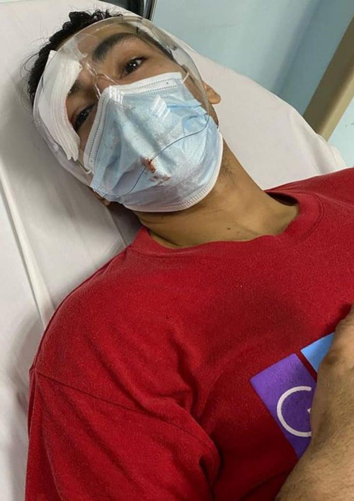 ‘Never felt so alive’: Carlos Agassi suffers injury after home gym ...